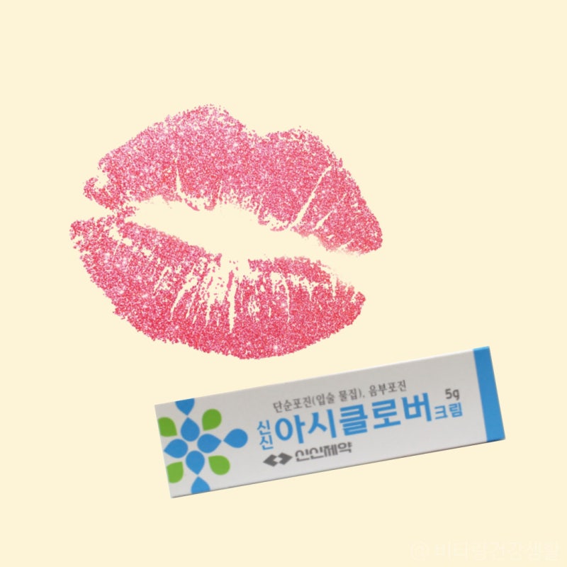 입술 헤르페스 감염 아시클로버 연고 효과는 어느정도 네이버 블로그
