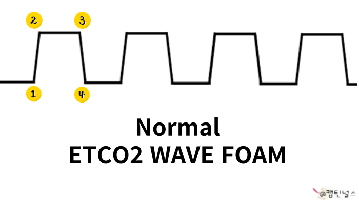 ETCO2 호기말 이산화탄소 측정 이유 및 정상 범위 그리고 올바른 ETCO2 그래프와 적용 방법 : 네이버 블로그