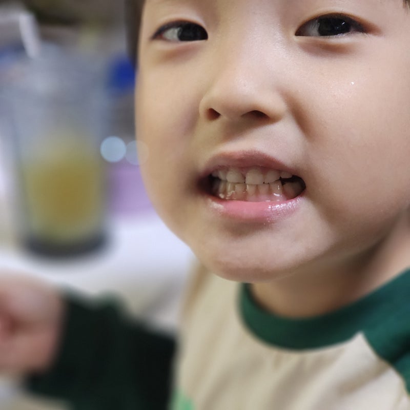 아기 입술 찢어짐 순소대 상순소대 대처법 네이버 블로그