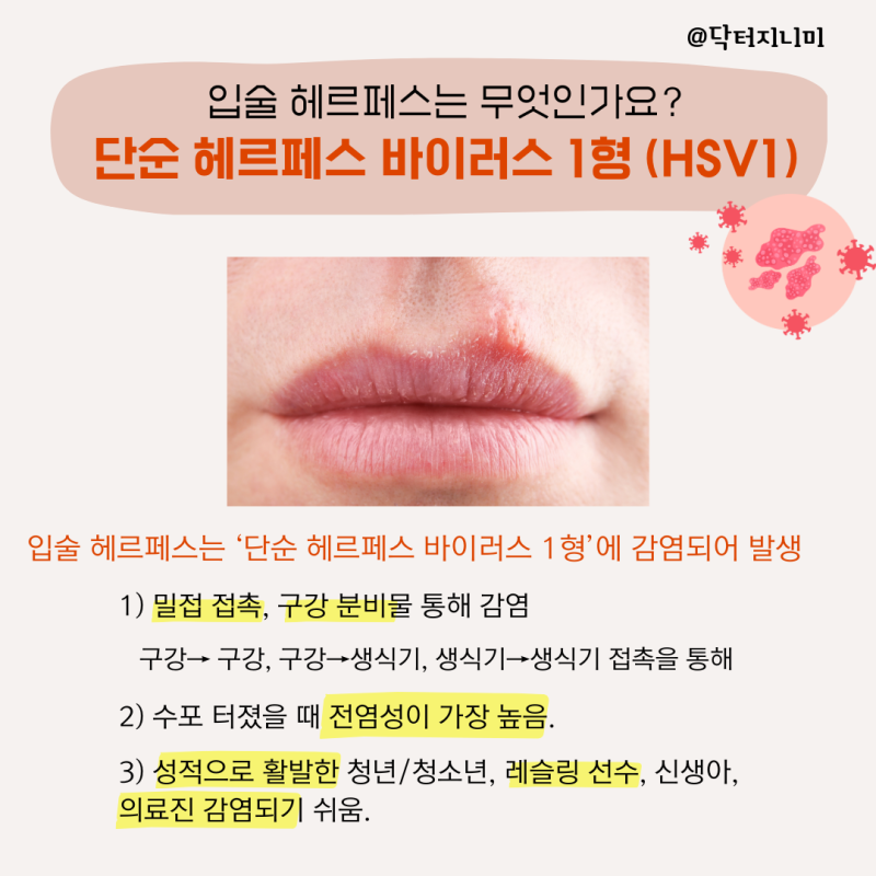 입술 헤르페스 수포 과연 전염이 되나요 증상과 치료 예방법까지 단순 헤르페스 바이러스 1 관련된 전반적인 내용까지