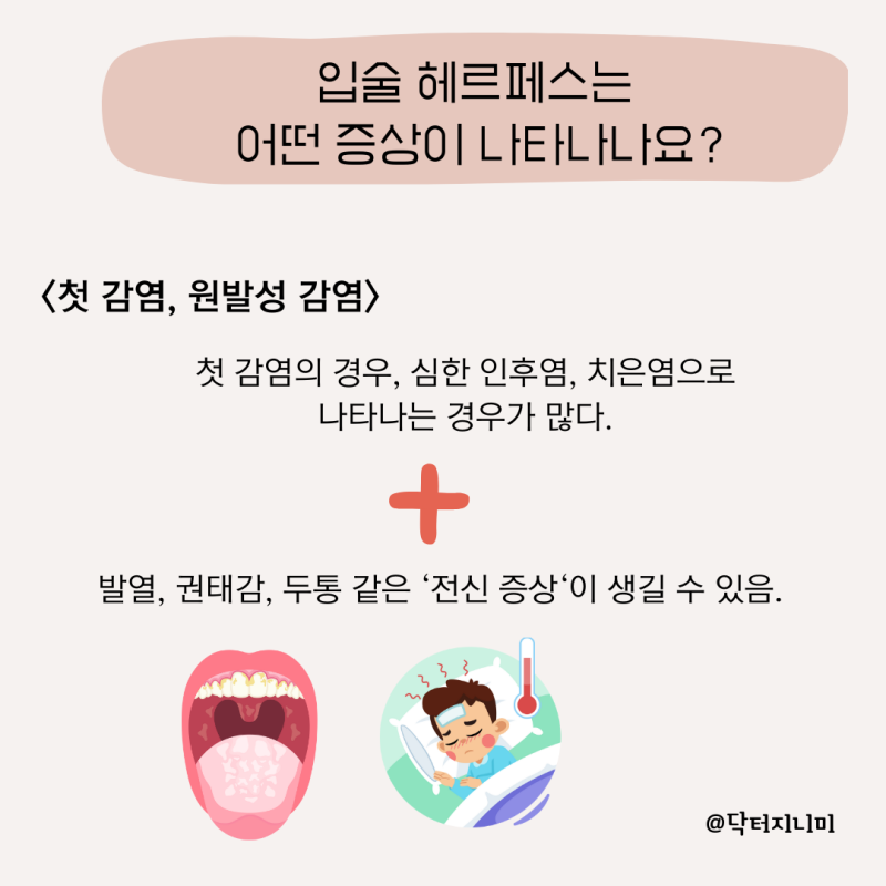 입술 헤르페스 수포 과연 전염이 되나요 증상과 치료 예방법까지 단순 헤르페스 바이러스 1 관련된 전반적인 내용까지