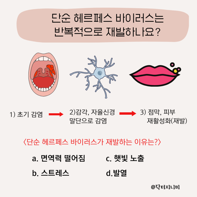 입술 헤르페스 수포 과연 전염이 되나요 증상과 치료 예방법까지 단순 헤르페스 바이러스 1 관련된 전반적인 내용까지