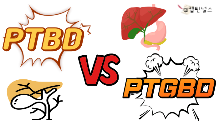 PTBD와 PTGBD 차이점 및 목적 그리고 시술 후 간호 : 네이버 블로그