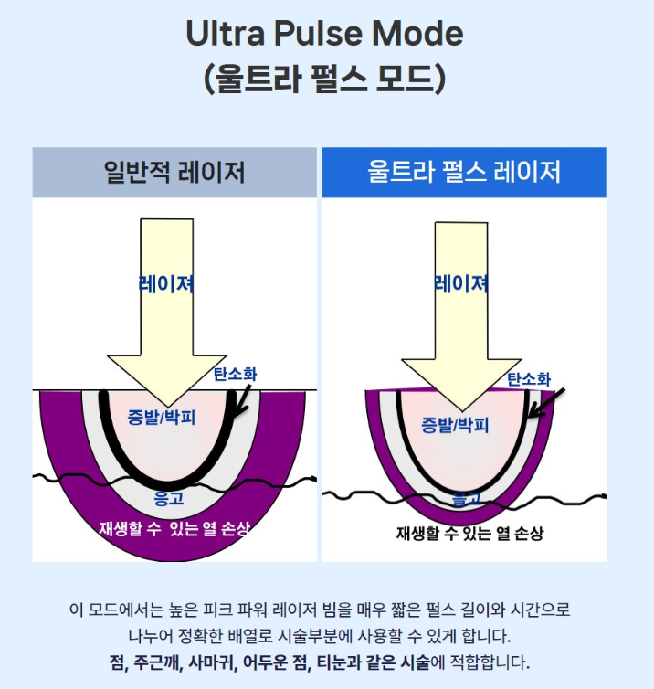 CO2레이저 스펙 비교분석 (Stratek Costa STL-3000P, COSCAN Ⅱ, Pentagon G Slim ...