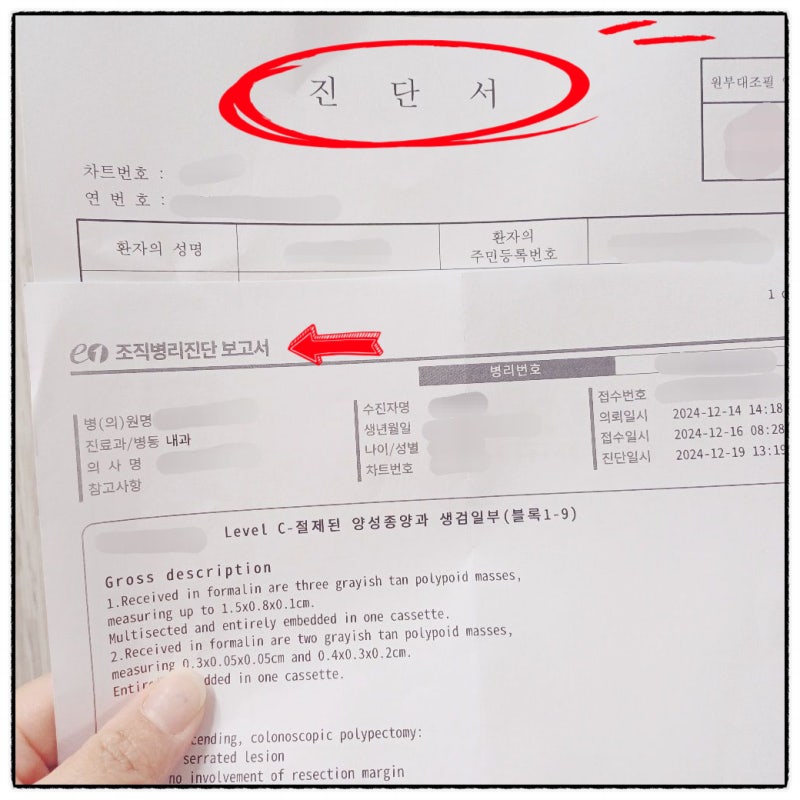 대장 용종 후기 선종 2개 제거 질병코드 D126 조직검사 결과지와 진단서 발급 네이버 블로그