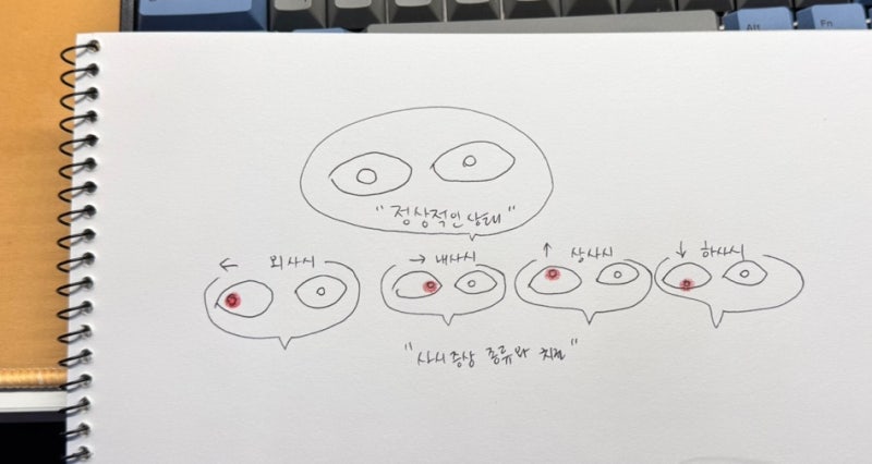 눈사시 사시증상 신생아 아기 유아 간헐적 외사시 하사시 상사시 내사시 특징 네이버 블로그