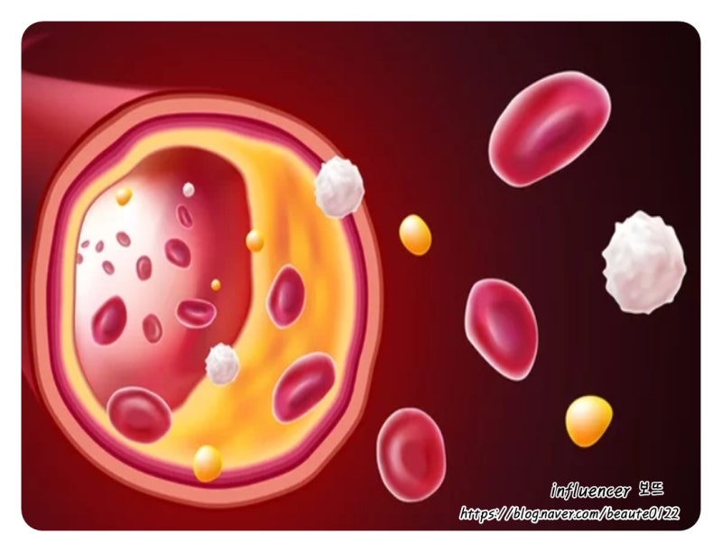 LDL 콜레스테롤 정상수치 LDL 콜레스테롤 높으면 낮으면 150 170 180 200 어떻게? : 네이버 블로그