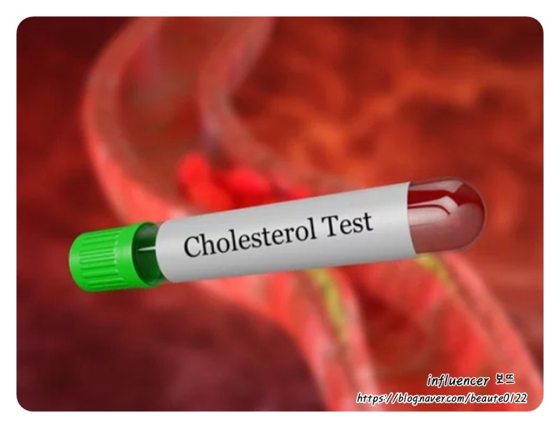 LDL 콜레스테롤 정상수치 LDL 콜레스테롤 높으면 낮으면 150 170 180 200 어떻게? : 네이버 블로그