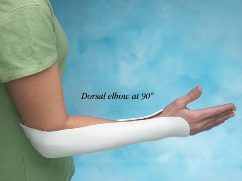 [간호사 공부] 정형외과 보조기 스플린트(Splint)의 종류에 대해 알아봅시다. : 네이버 블로그