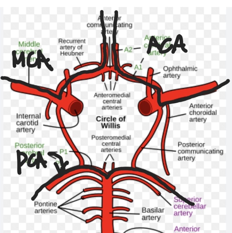 MCA, ACA, PCA 의학용어 총정리, 뇌혈관 손상별 증상 이렇게 다르다 : 네이버 블로그