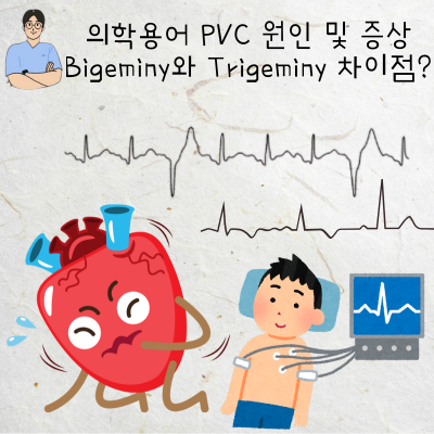 의학용어 PVC 조기심실수축 원인과 증상 및 PVC Bigeminy, Trigeminy 차이는? : 네이버 블로그