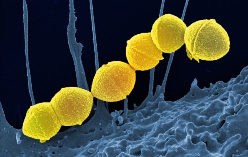 성홍열 검사 키트 비용 방법 Streptococcus pyogenes : 네이버 블로그