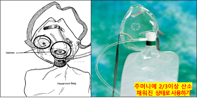 산소요법 종류: 비강캐뉼라, 단순 안면 마스크, 부분재호흡 마스크, 비재호흡마스크, 벤츄리 마스크 : 네이버 블로그