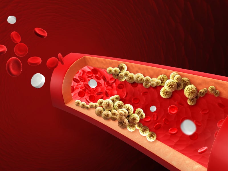 혈액검사 Cbc검사 정상 수치백혈구 Wbc 적혈구 Rbc 혈색소 Hb 혈소판 Platelet 네이버 블로그