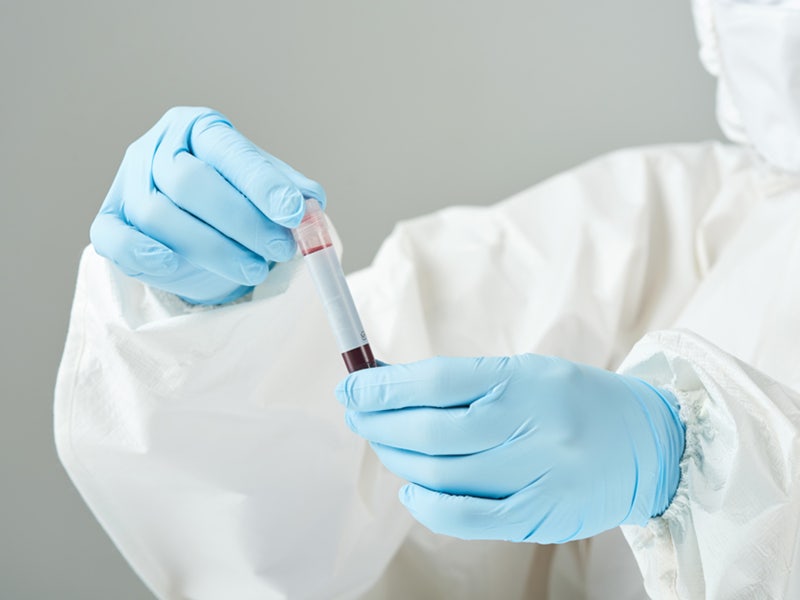 혈액검사 Cbc검사 정상 수치백혈구 Wbc 적혈구 Rbc 혈색소 Hb 혈소판 Platelet 네이버 블로그