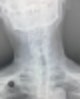 영상의학과 일반촬영 시리즈 X-Ray Series(SKULL,PNS,MANDIBLE,CTL-SPINE,SACRUM,COCCYX ...