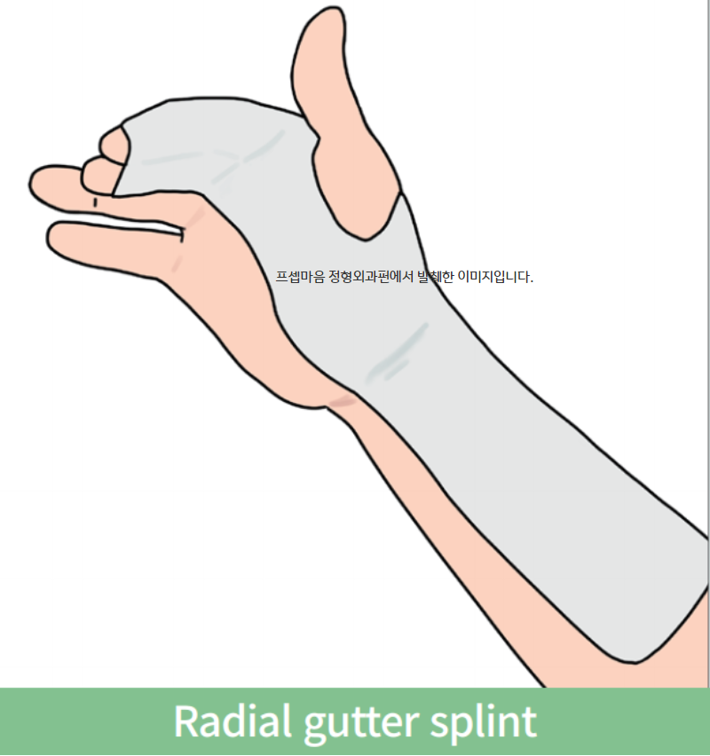[응급실간호] splint 종류 1편. 상지 splint, armsling 총정리 : 네이버 블로그