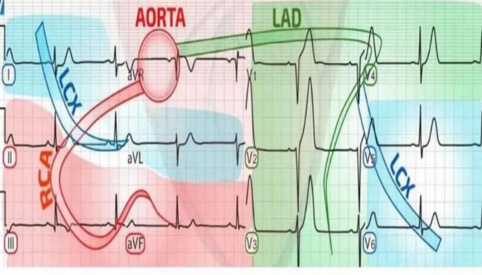 CAG(Coronary Angiography) 시행하는 이유와 RCA, LCA, LCX, LAD 위치는? : 네이버 블로그