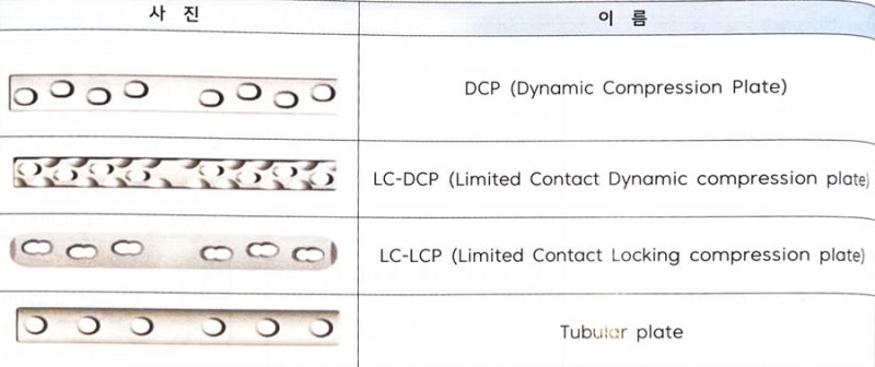 정형외과(OS) 수술실 Plate: Shape / Type / Function Part.1 : 네이버 블로그