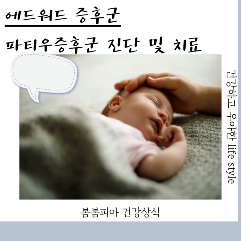 에드워드 증후군 특징 파티우증후군 원인 증상 진단 네이버 블로그