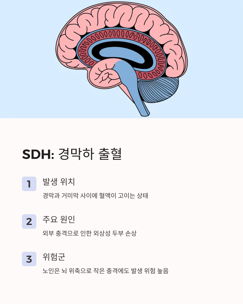 다섯가지 뇌출혈 유형 완벽 분석: SDH, EDH, SAH, ICH, IVH 정의 총정리 : 네이버 블로그