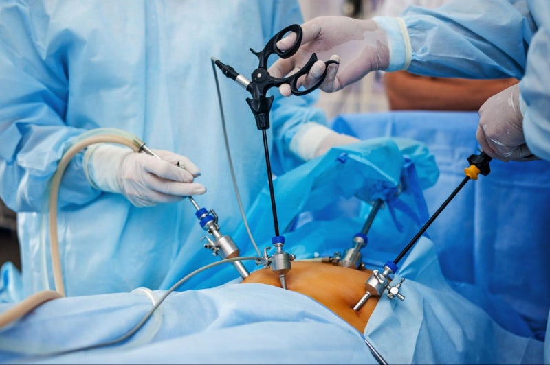 담낭절제술 Cholecystectomy요약 네이버 블로그