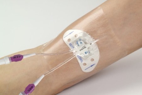 중심정맥관? : [PICC, Chemoport, C-line, Hickman, Perm, AK catherter에 대해 알아보기 ...