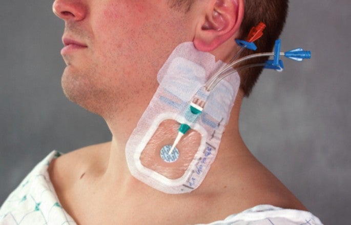 중심정맥관? : [PICC, Chemoport, C-line, Hickman, Perm, AK catherter에 대해 알아보기 ...