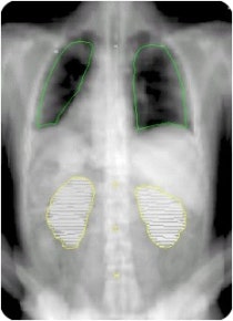 CT-simulation process : 네이버 블로그