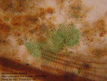 Aphanocapsa elachista W. et G.S. West (아파노캅사, 남조류) : 네이버 블로그