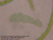 Microcrocis irregularis (Lagerheim) Geitler (남조류) : 네이버 블로그